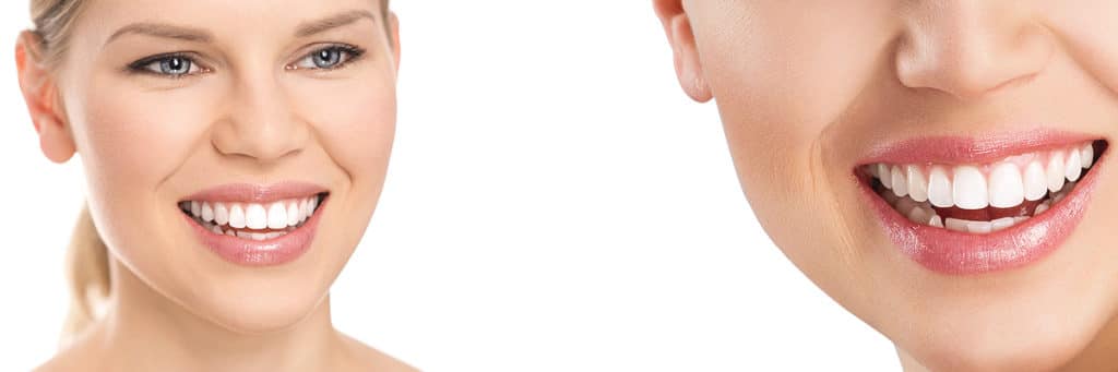 A Straight Smile Is the Best First Impression - Sokoloff Orthodontics