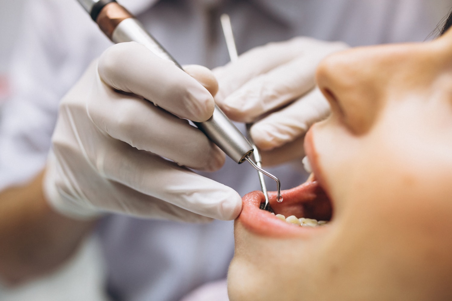Advantages of Clear Braces - Sokoloff Orthodontics