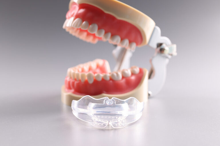 Retainers After Braces: Proven Steps for Long-Term Results