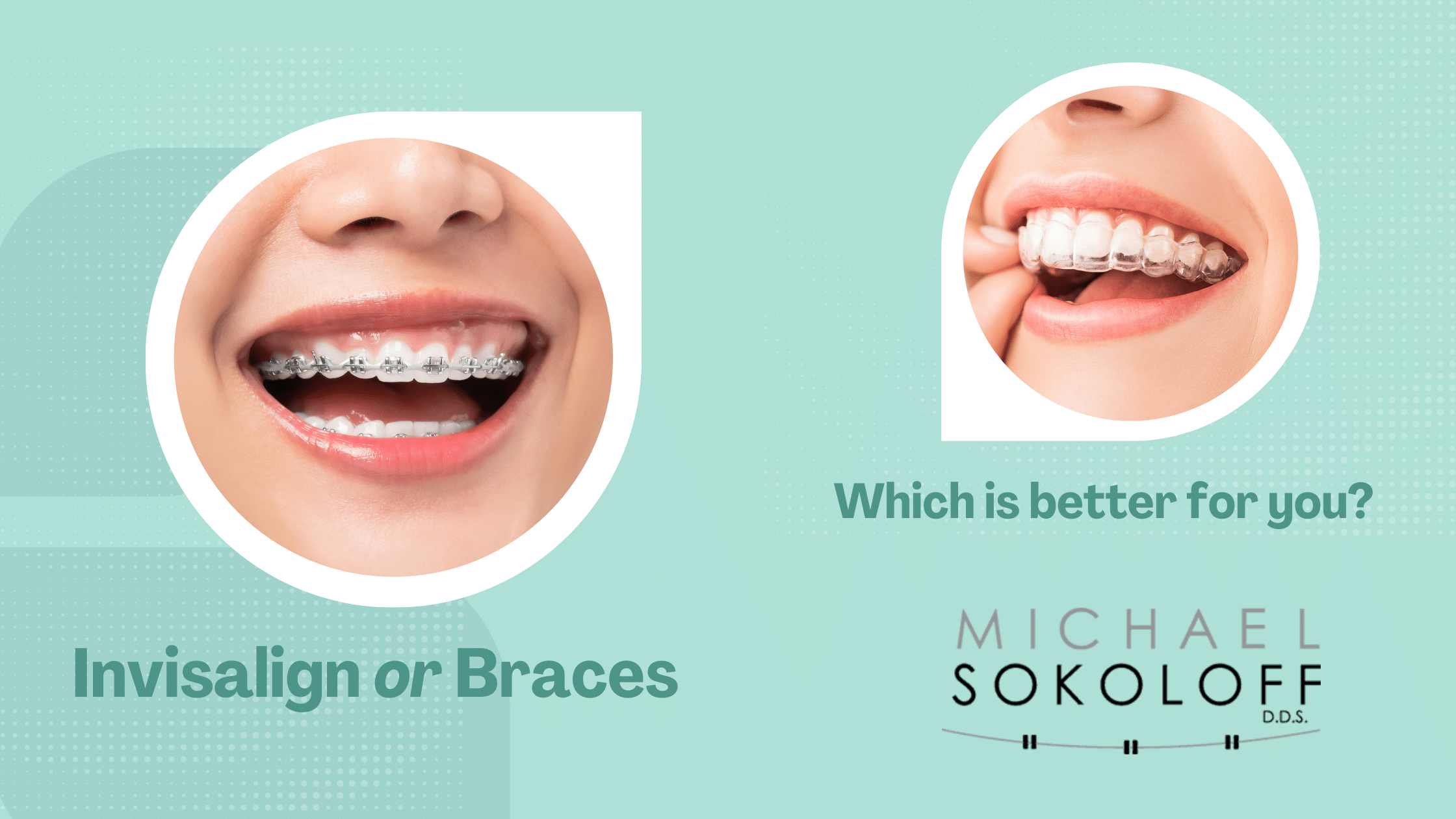 Invisalign or Braces: Which is Better? - Sokoloff Orthodontics